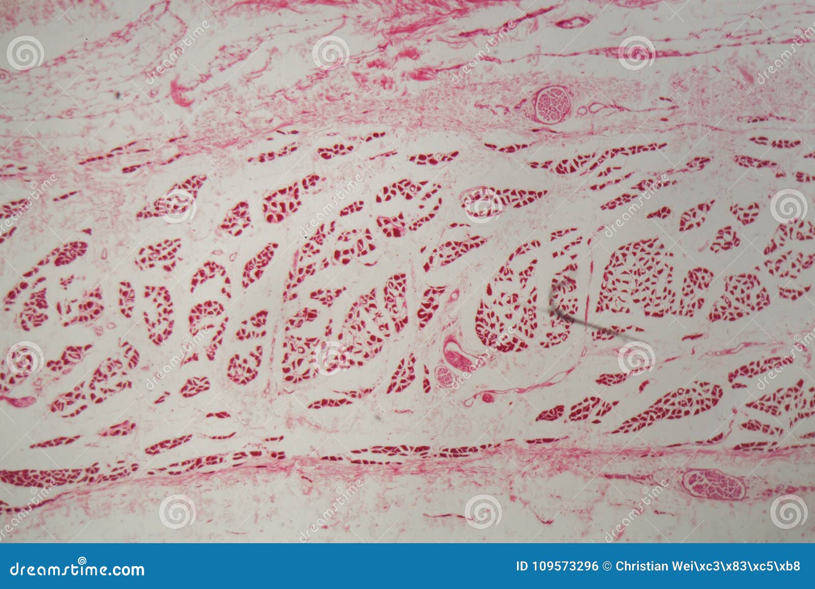 Detail of Skin Under the Microscope. Stock Photo - Image of nature ...