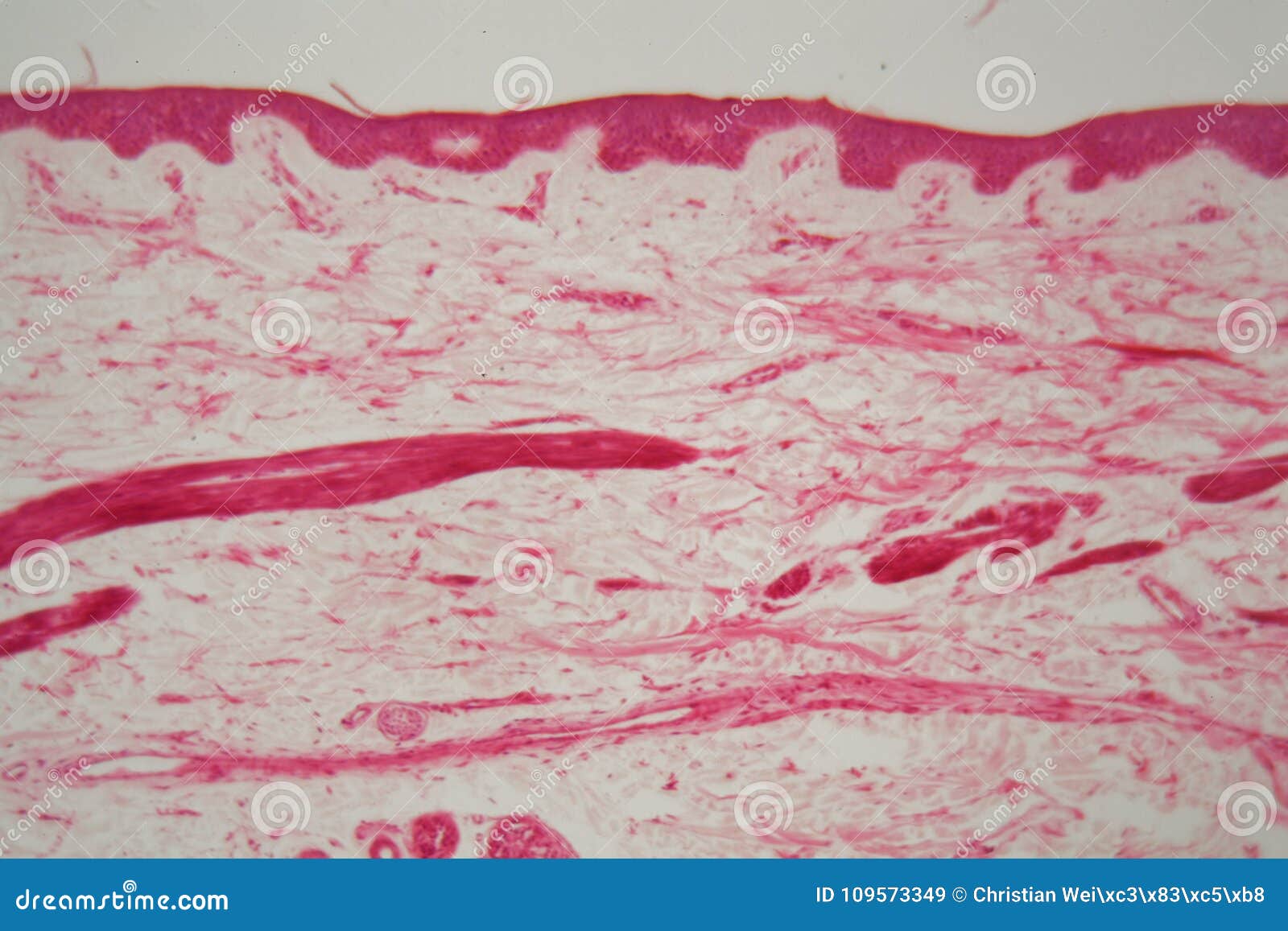 Detail of Skin Under the Microscope. Stock Image - Image of education ...
