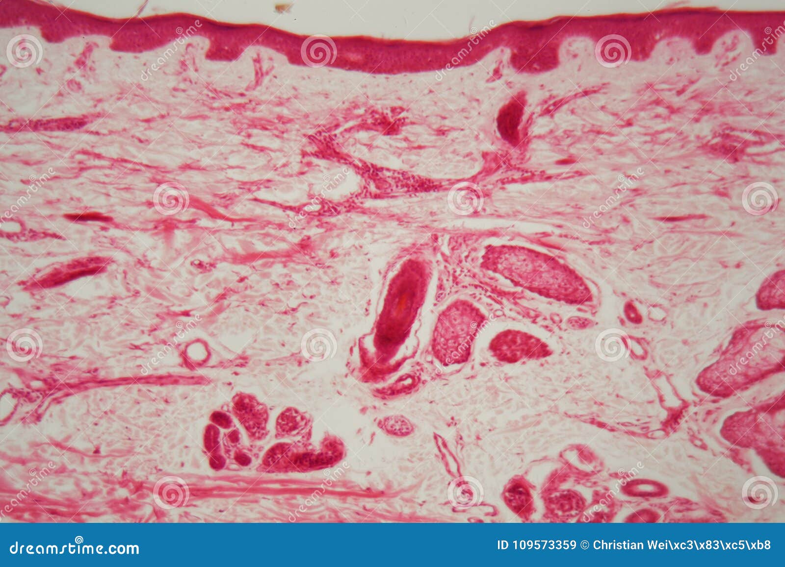 Detail of Skin Under the Microscope. Stock Image - Image of clinical ...