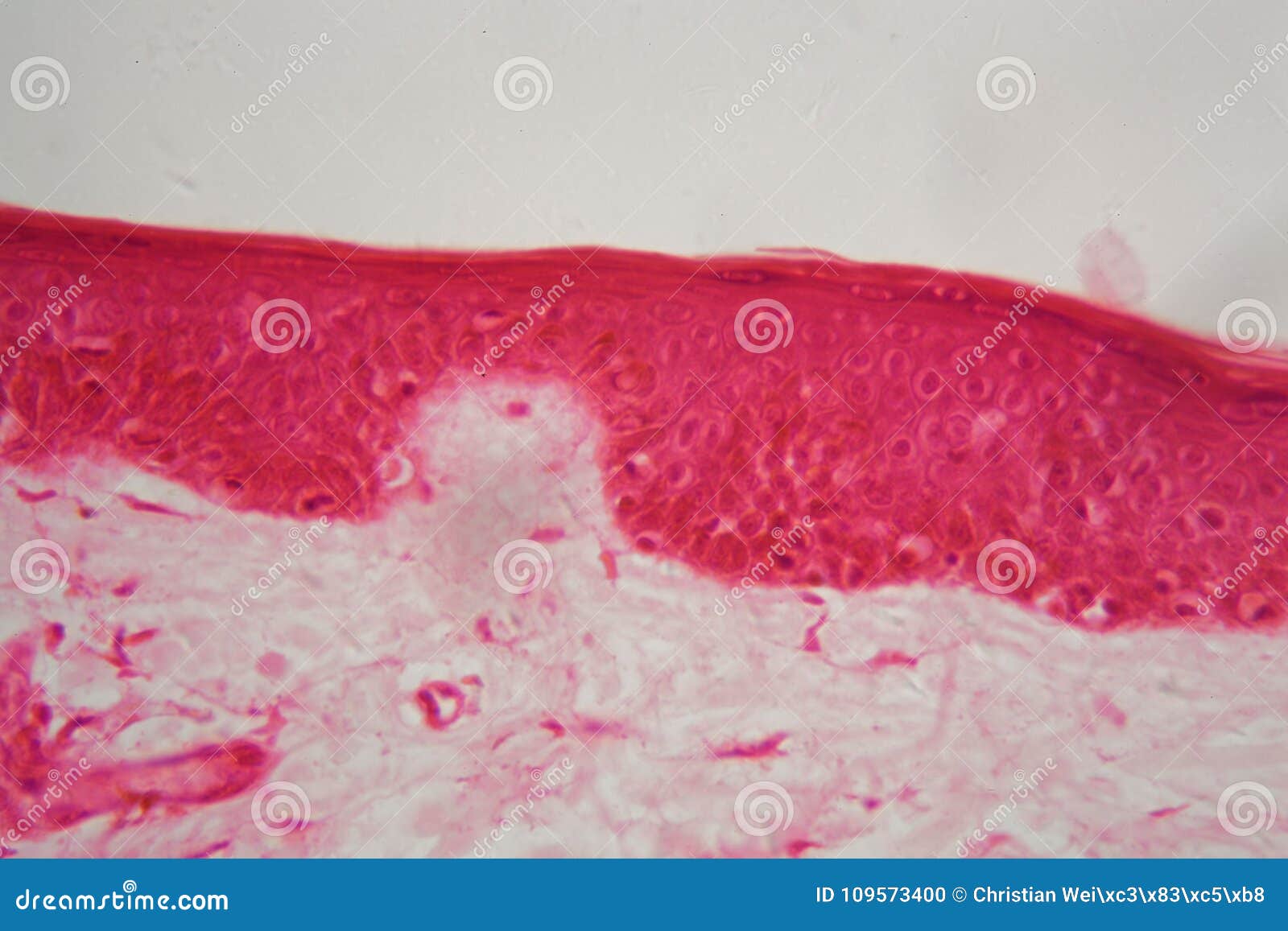 Detail of Skin Under the Microscope. Stock Photo - Image of pathology ...