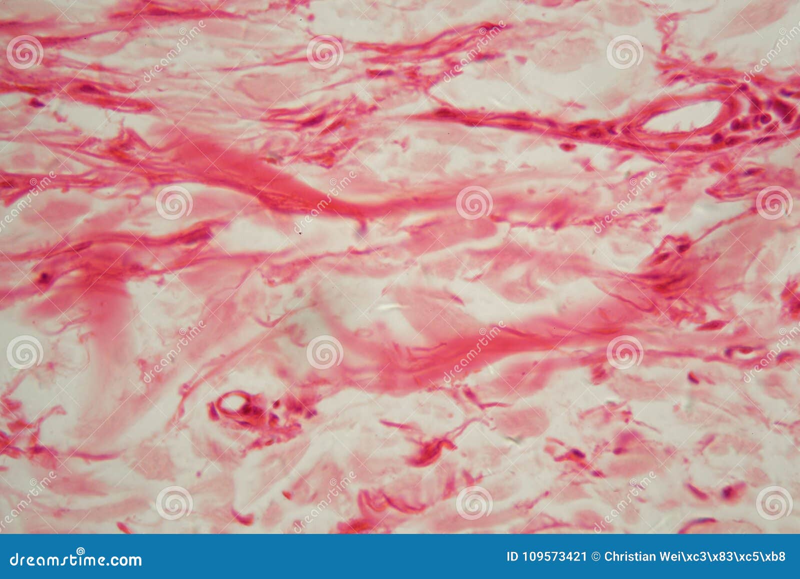 Detail of Skin Under the Microscope. Stock Image - Image of epidermis ...