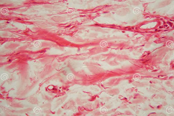 Detail of Skin Under the Microscope. Stock Image - Image of epidermis ...