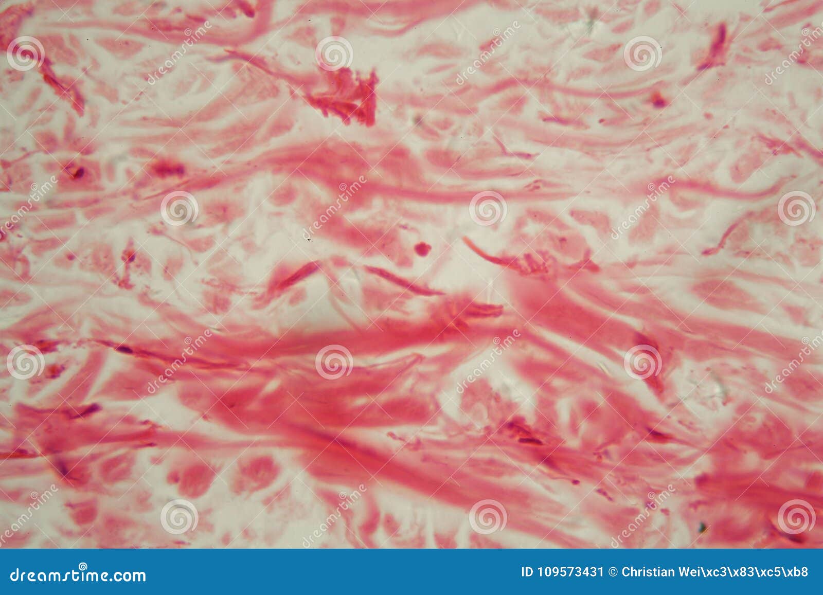 Detail of Skin Under the Microscope. Stock Image - Image of clinical ...