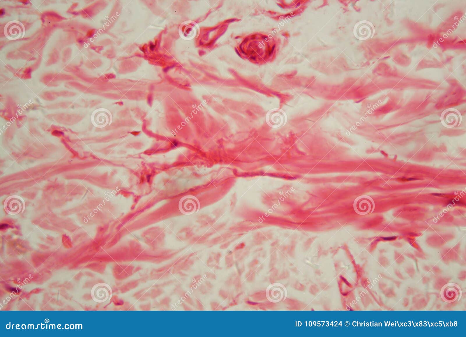Detail of Skin Under the Microscope. Stock Photo - Image of clinical ...
