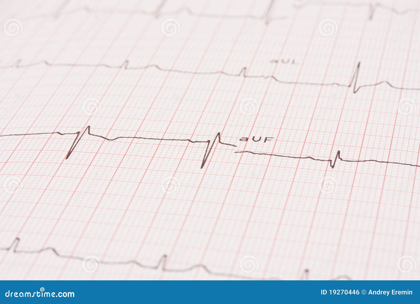 Detail Van Een Elektrocardiogram Stock Foto - Image of kardiogram ...