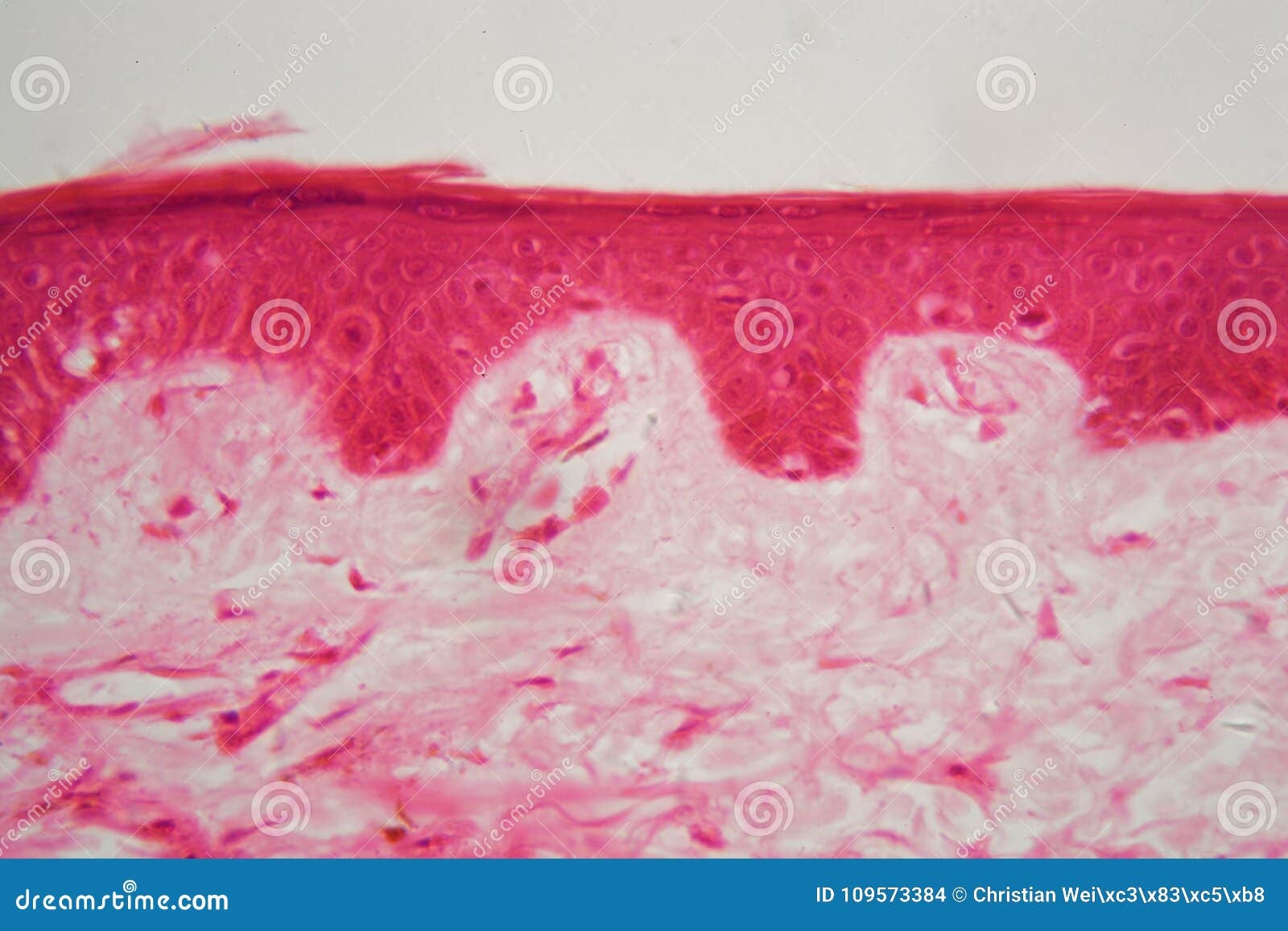 Detail Van Huid Onder De Microscoop Stock Foto - Image of anatomie ...
