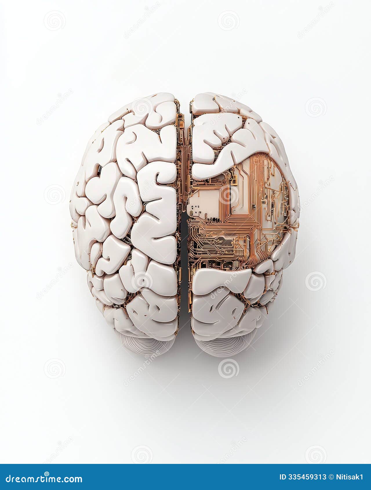 Brain MRI Revealing Chronic Ischemic Stroke And Cerebral Infarction ...