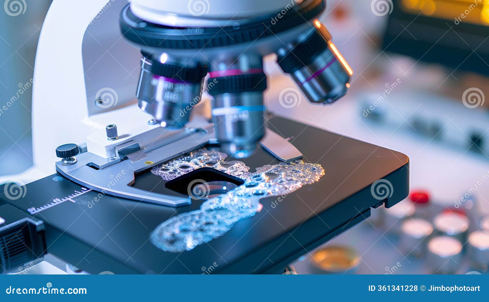 Detailed Cancer Biopsy Sample Stock Illustration - Illustration of ...