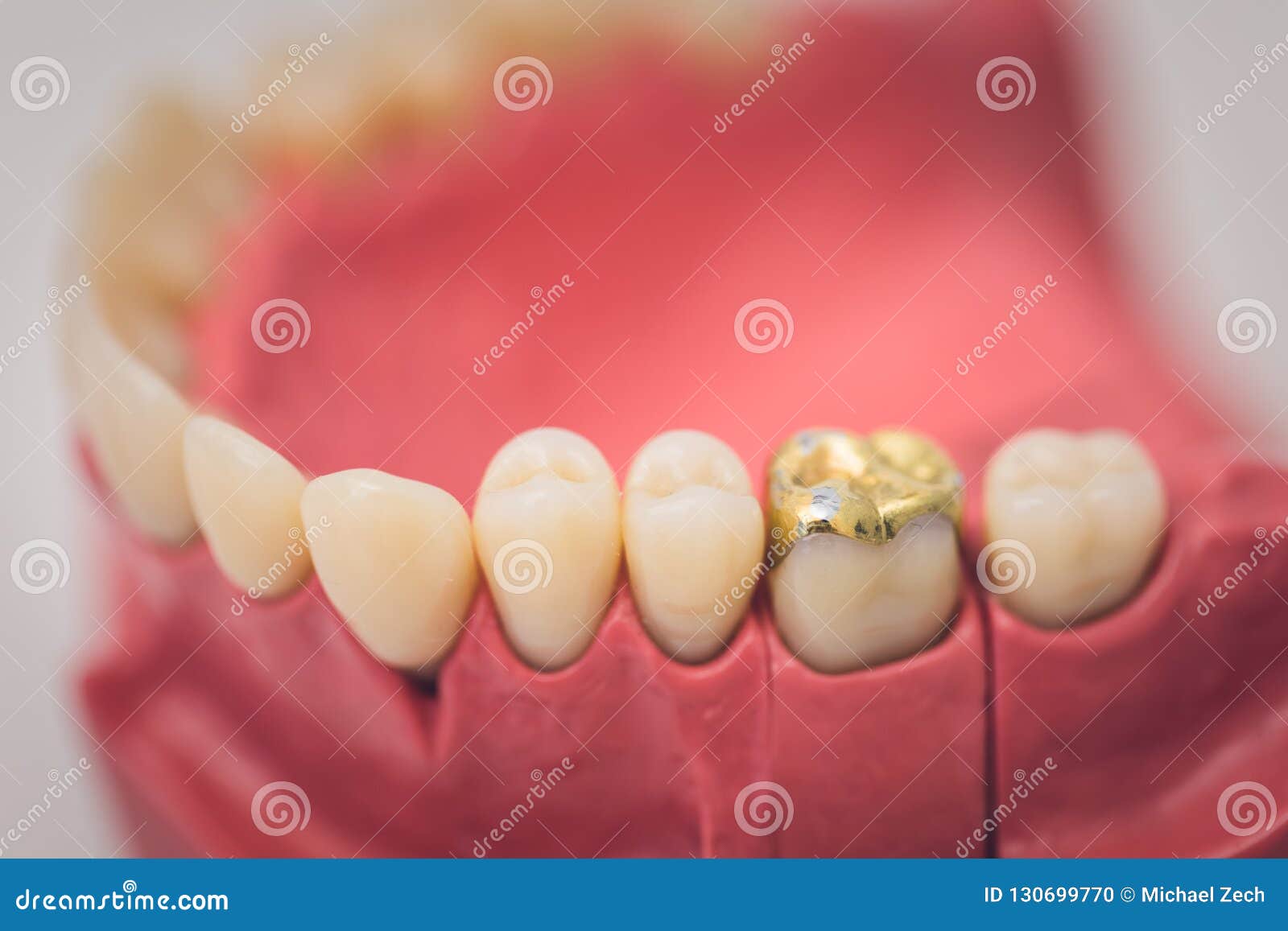Detailed Close Up of Dental Denture or Teeth on a Table Stock Photo ...