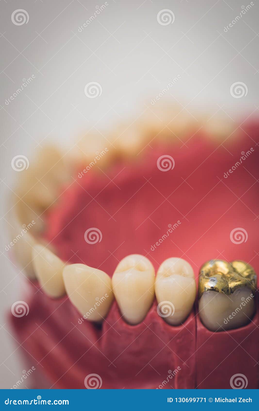 Detailed Close Up of Dental Denture or Teeth on a Table Stock Image ...