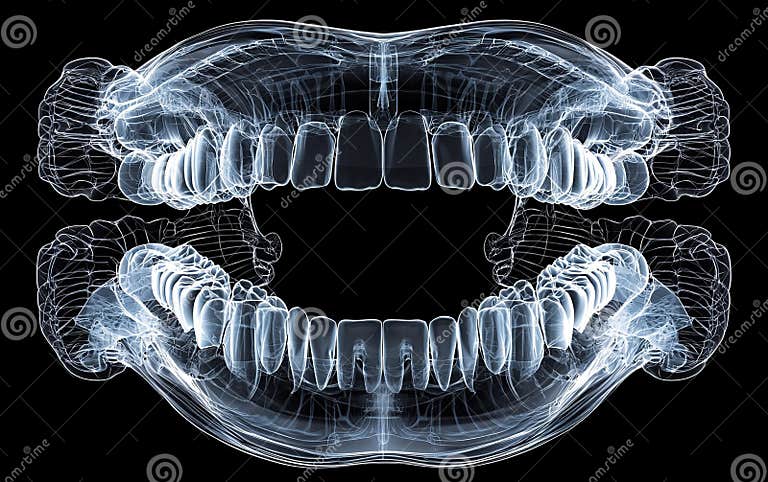 Detailed 3D X-ray Visualization of a Human Jaw Showing Upper and Lower ...