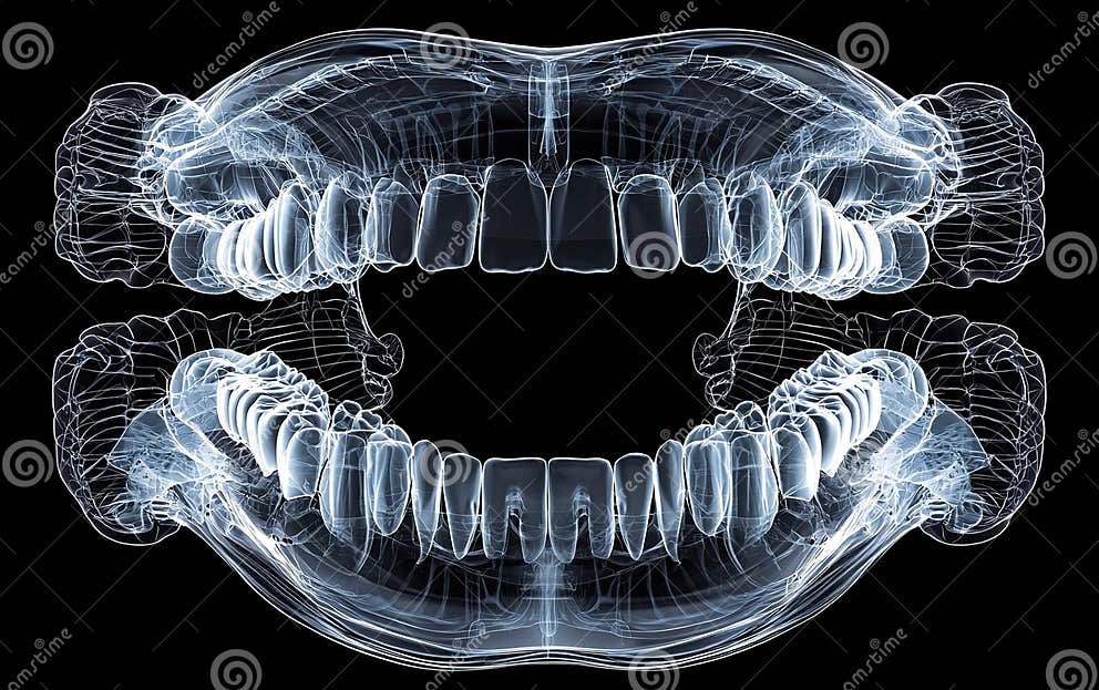 Detailed 3D X-ray Visualization of a Human Jaw Showing Upper and Lower ...
