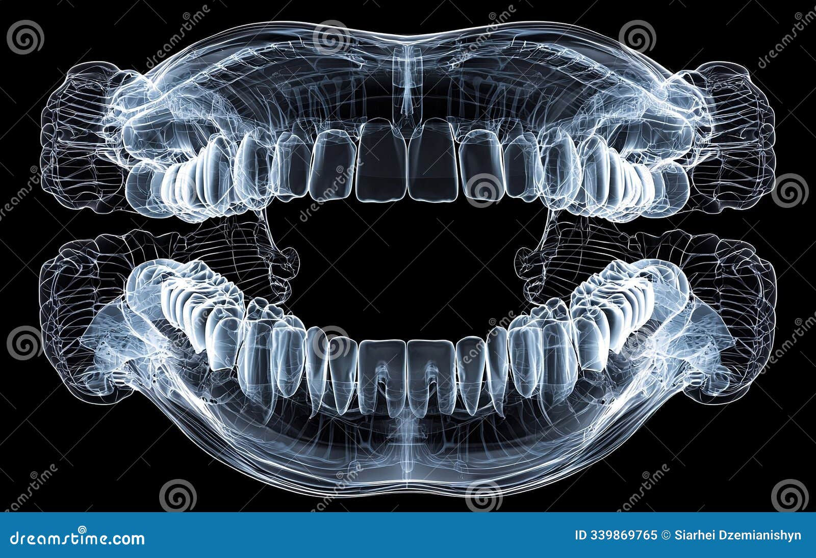 Detailed 3D X-ray Visualization Of A Human Jaw Showing Upper And Lower ...