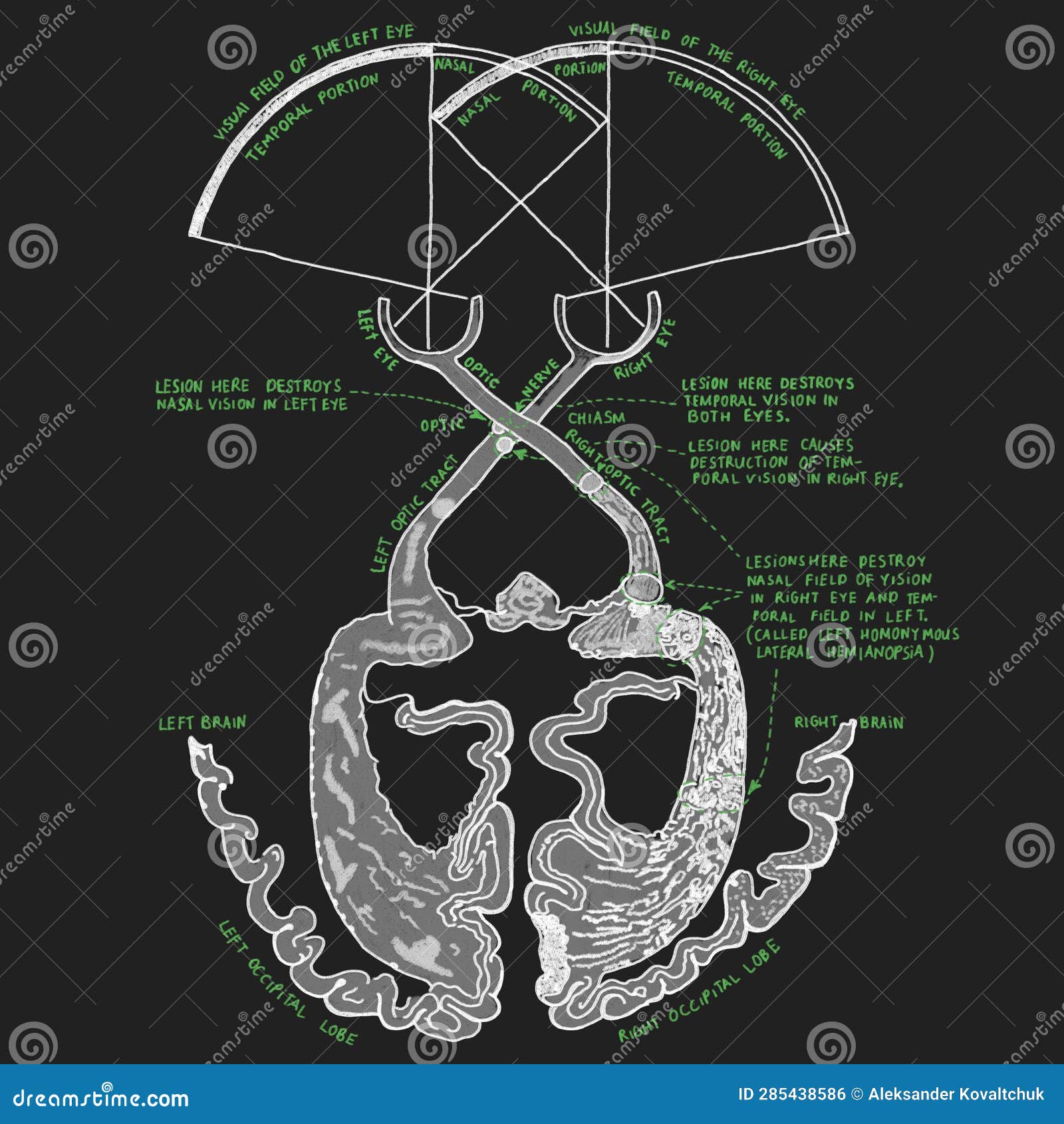 Visual Pathway With Eye, Optic Nerve And Visual Cortex 3D Rendering ...