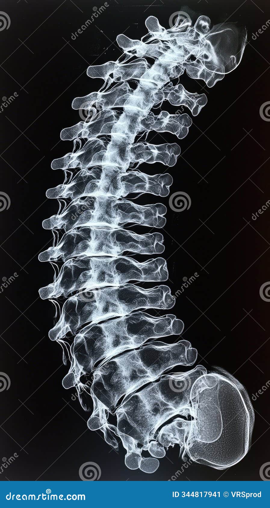 X-ray Side View of Human Spine, Digital Rendering Stock Image - Image ...