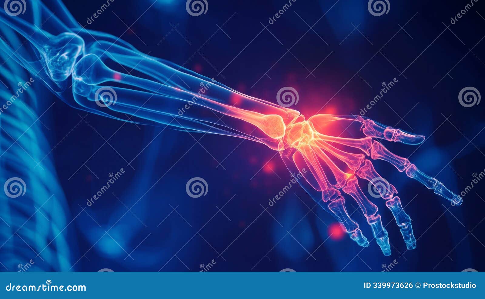Detailed Illustration of Human Arm Highlighting Bone Structure and ...