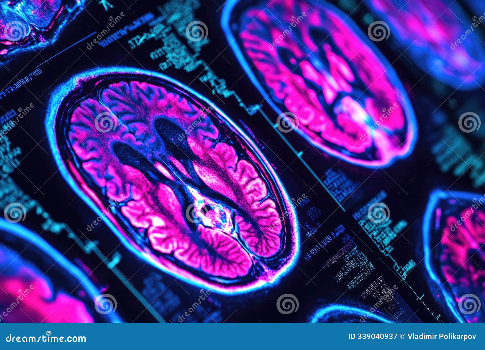 Detailed Image of a Human Brain Scan Showing Internal Structures and ...