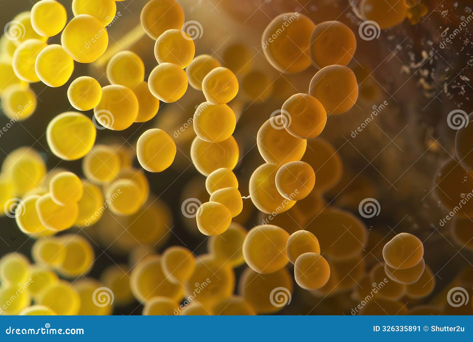 Detailed Image of Staphylococcus Aureus Colonies Showcasing the ...