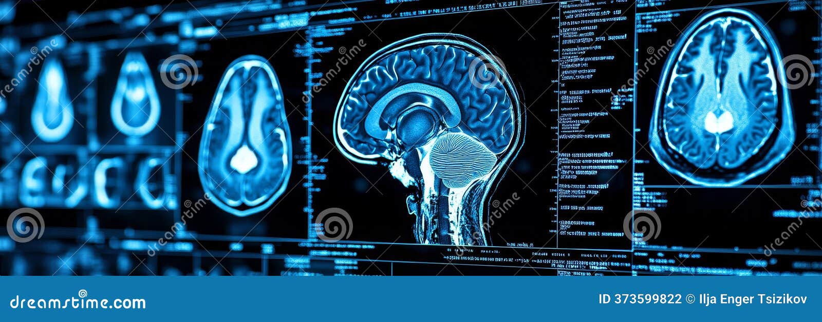 Exploring The Brain: The Intersection Of Neuroscience And Artificial ...