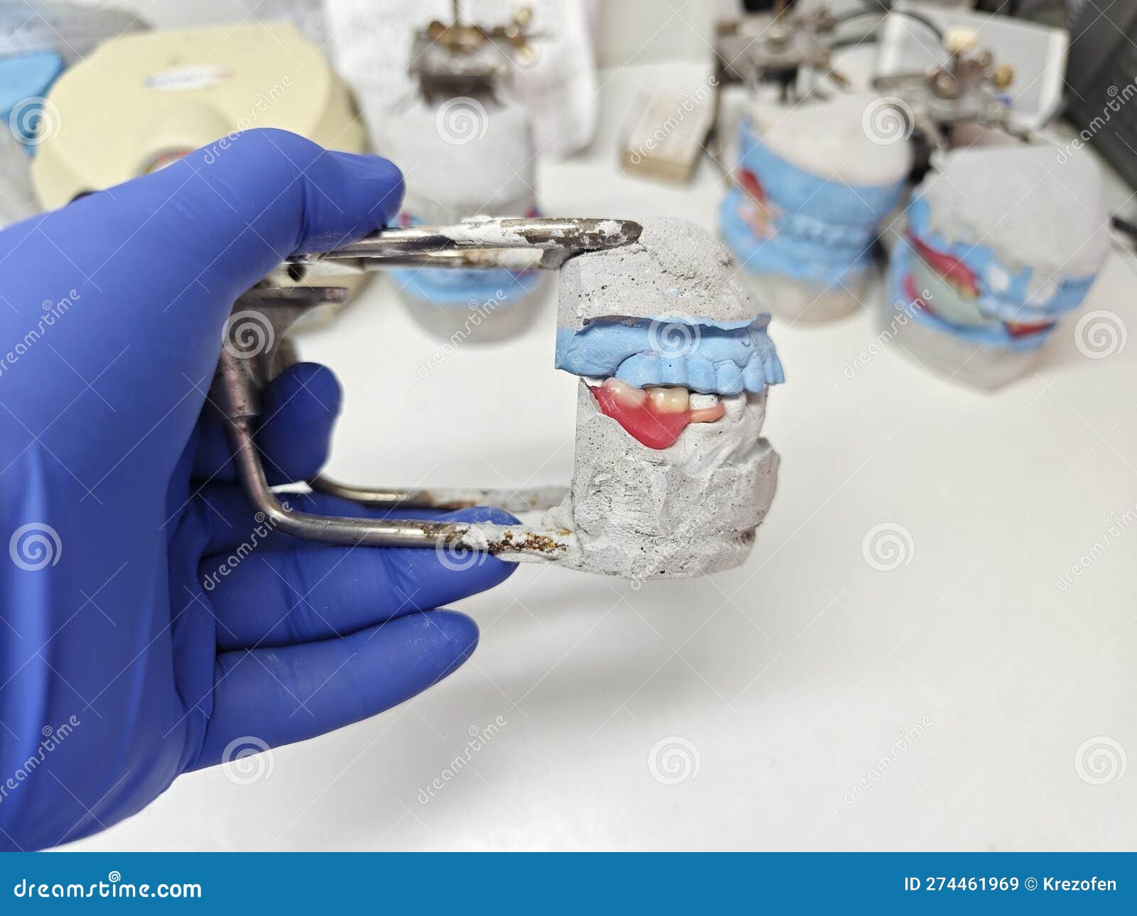 Detailed Plaster Models with Dentures Analogs in the Dental Laboratory ...