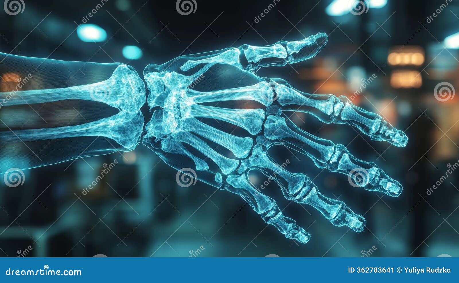 A Detailed X-ray of a Human Hand Revealing the Exact Bone and Joint ...