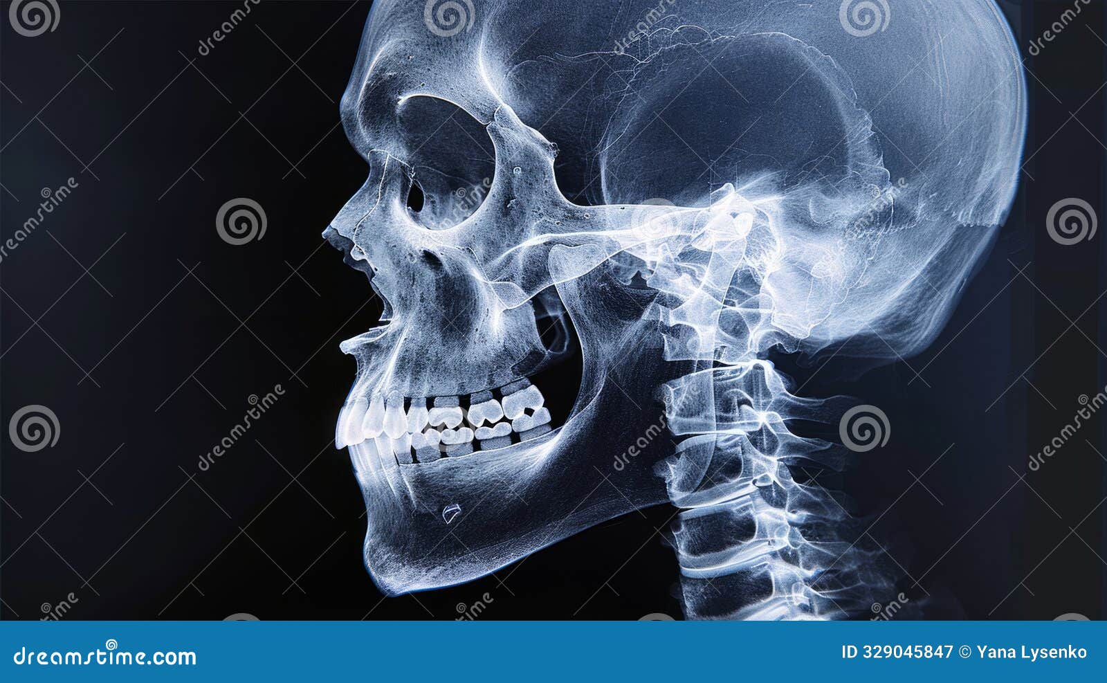 Detailed X-Ray Image of Human Skull and Cervical Spine Concept of ...