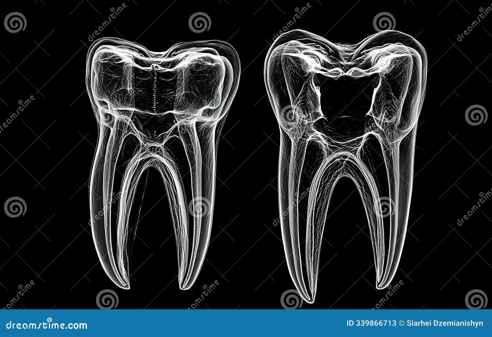 Detailed X-ray Images of Human Teeth Highlighting Root Structure and ...