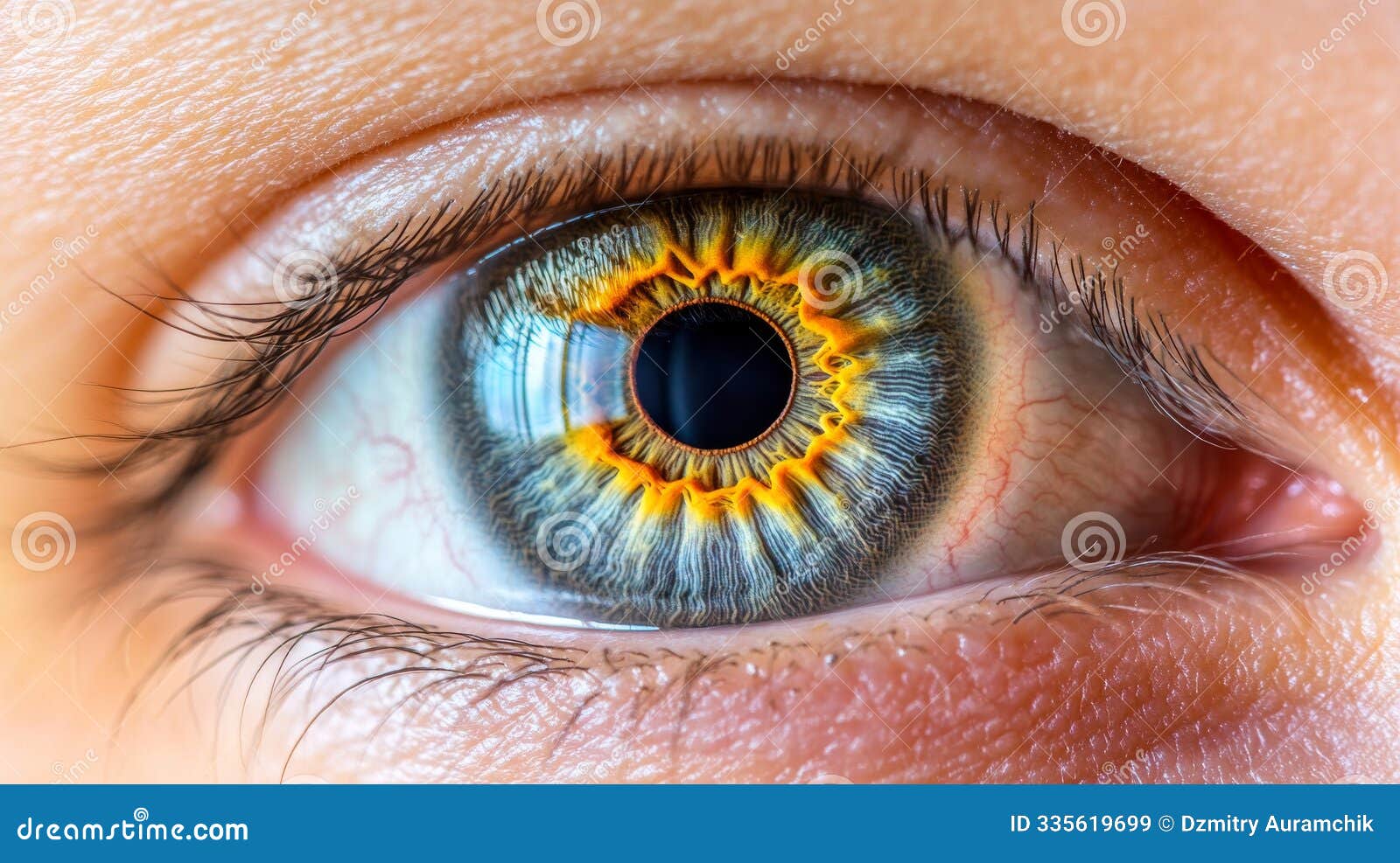 A Detailed Retinal Scan Using Optical Coherence Tomography (OCT): an ...