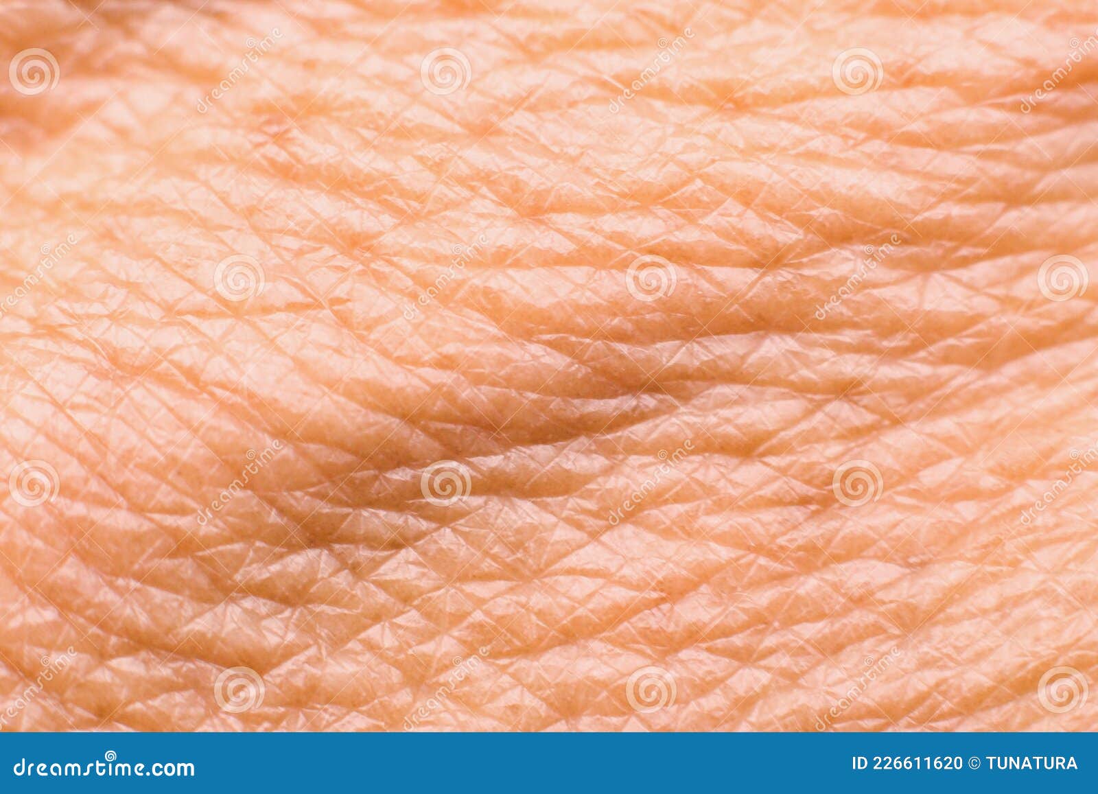 Detailed Texture of the Aging Dry Human Skin Stock Photo - Image of ...