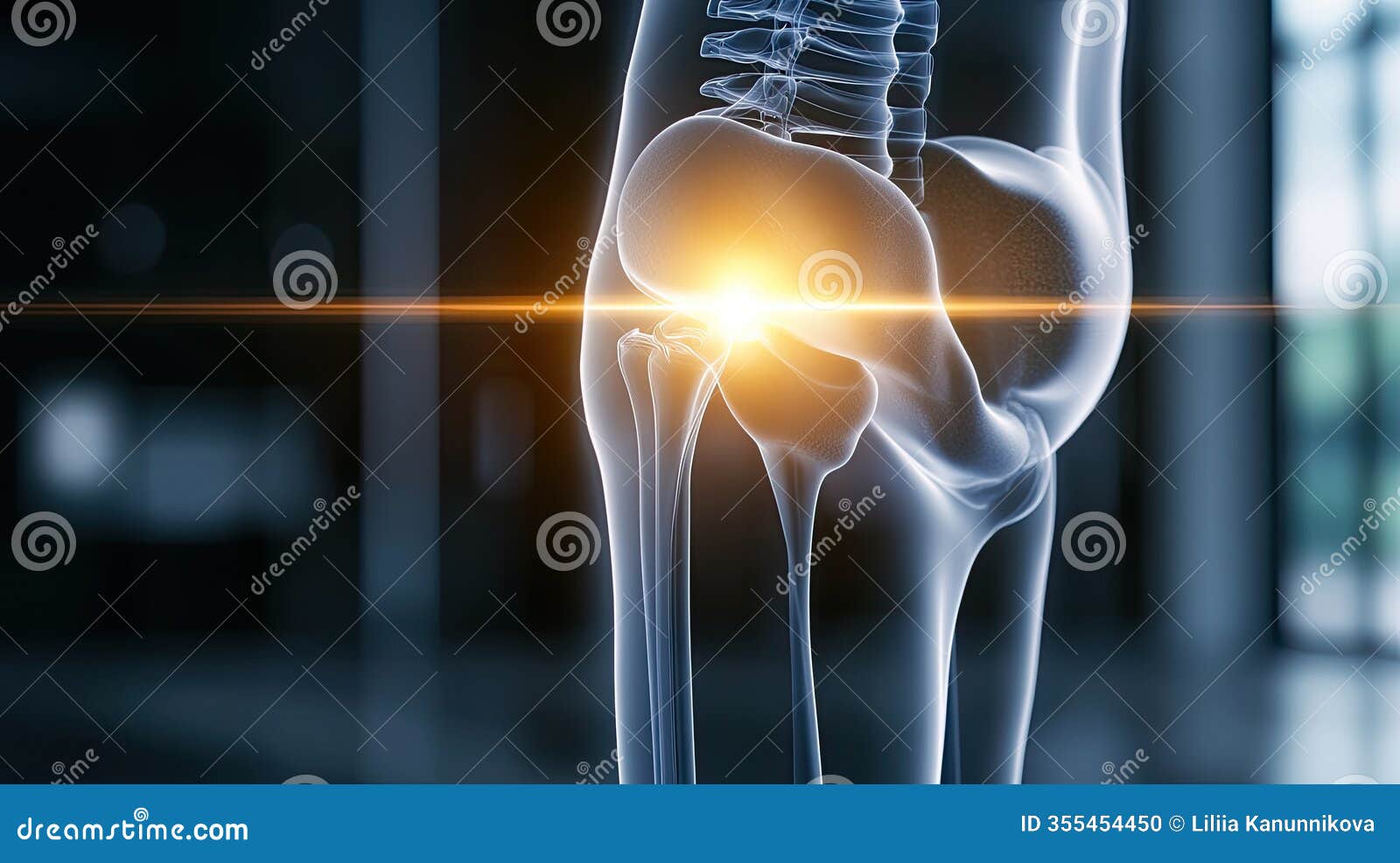 Detailed Visualization of a Hip Joint Highlighting Orthopedic Features ...