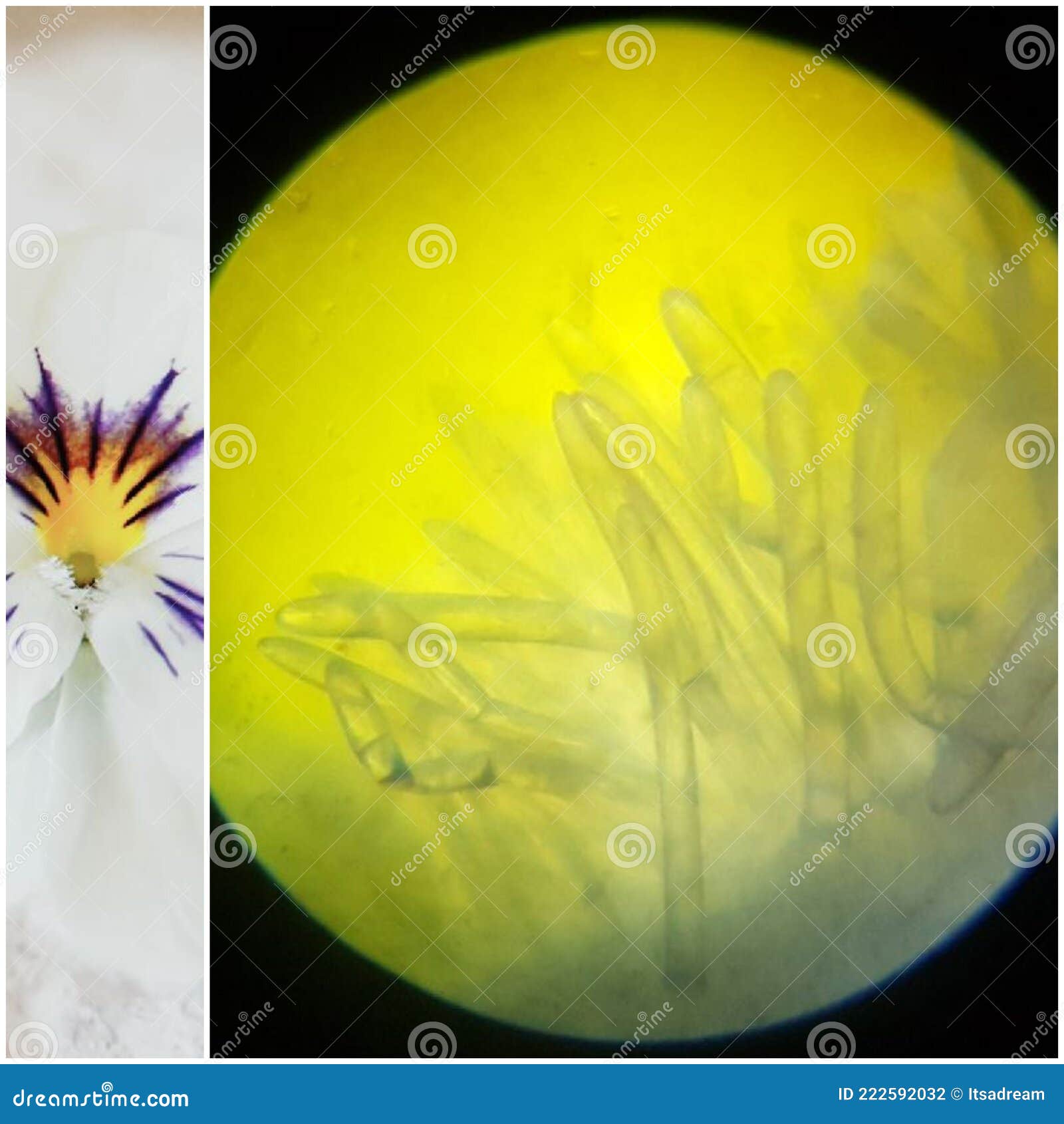 Microscope And Enlarged Cells On A Computer Screen Royalty-Free Stock ...