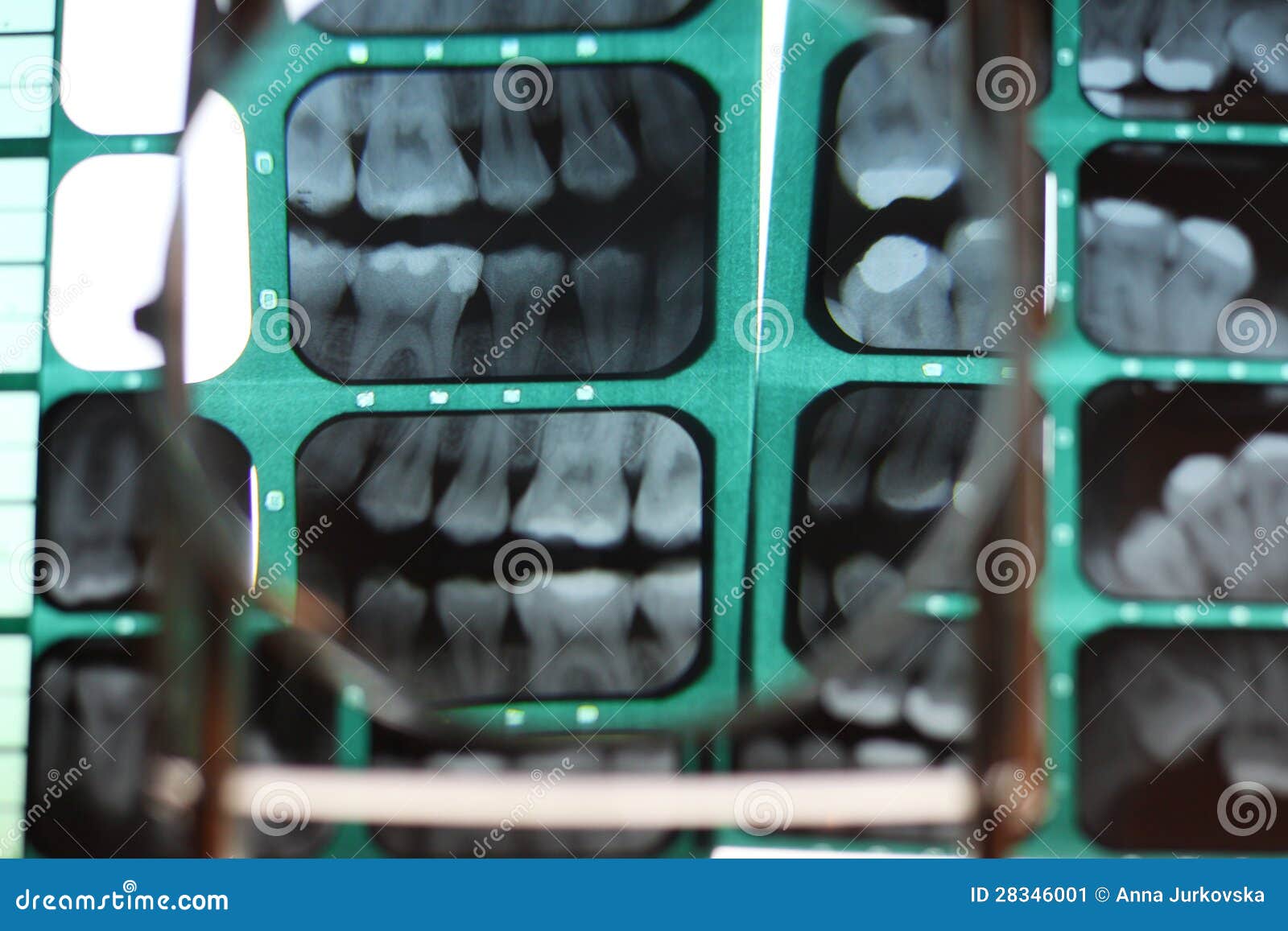 Details of Teeth Structure and Position Stock Image - Image of examine ...