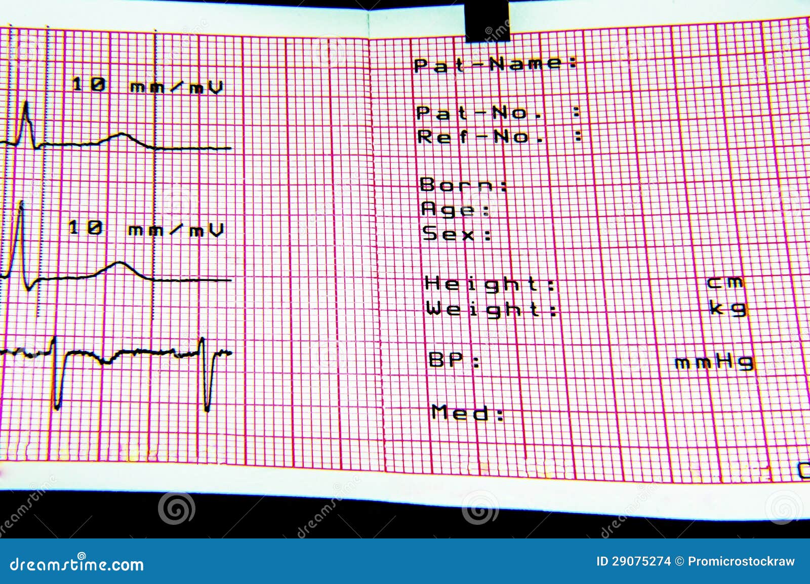 Detalles Del Paciente De ECG EKG Imagen. Imagen: 29075274