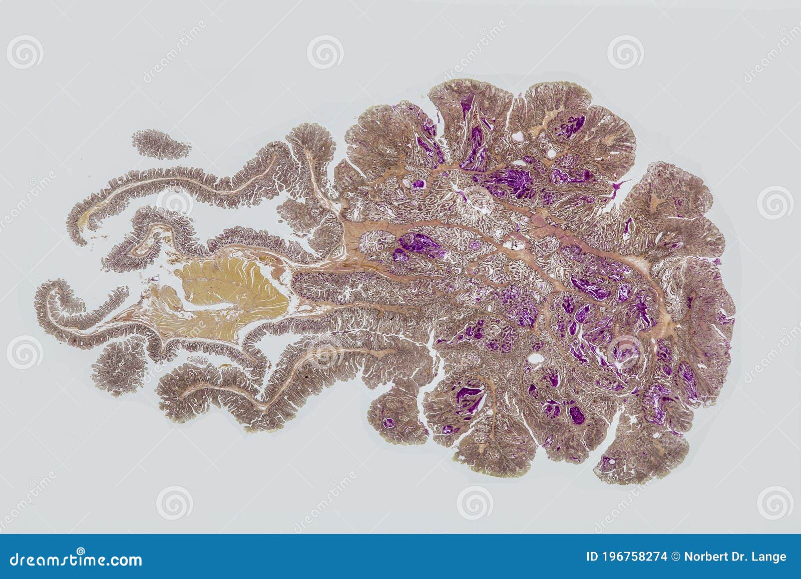 Deux points de polype photo stock. Image du accroissement - 196758274