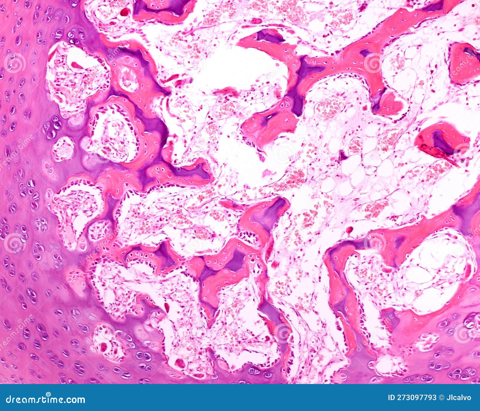 Developing Bone. Epiphyseal Ossification Stock Image - Image of ...