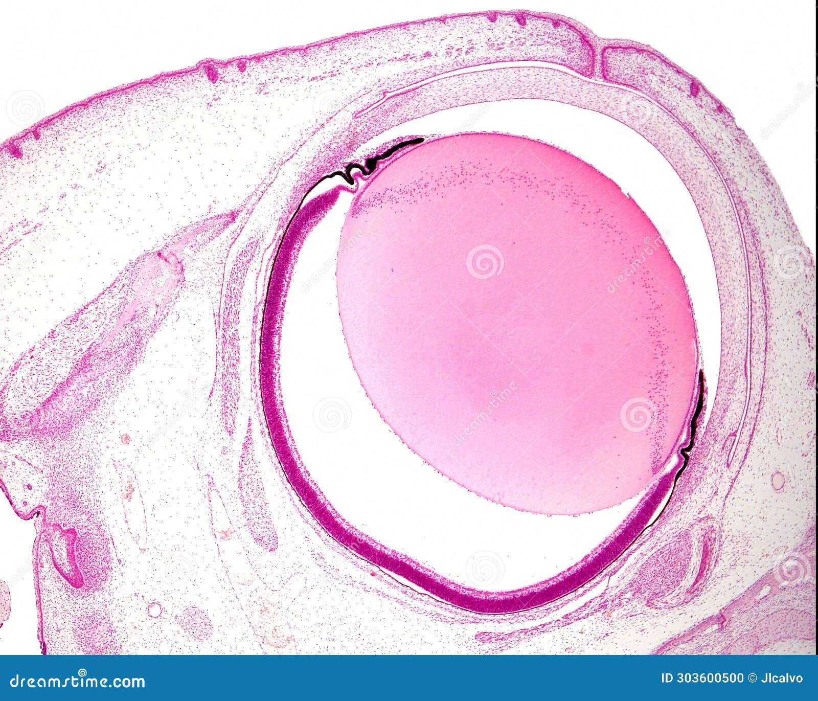 Developing cat eye stock photo. Image of microscopic - 303600500