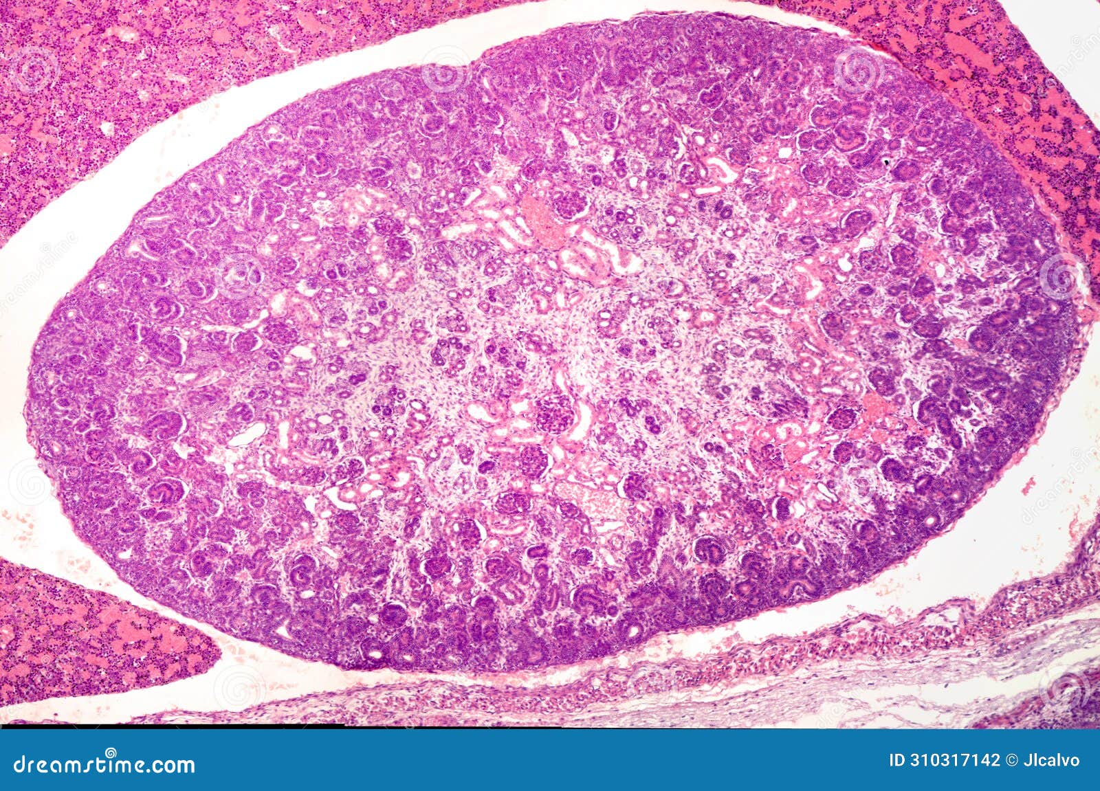 Developing kidney stock photo. Image of zone, urinary - 310317142