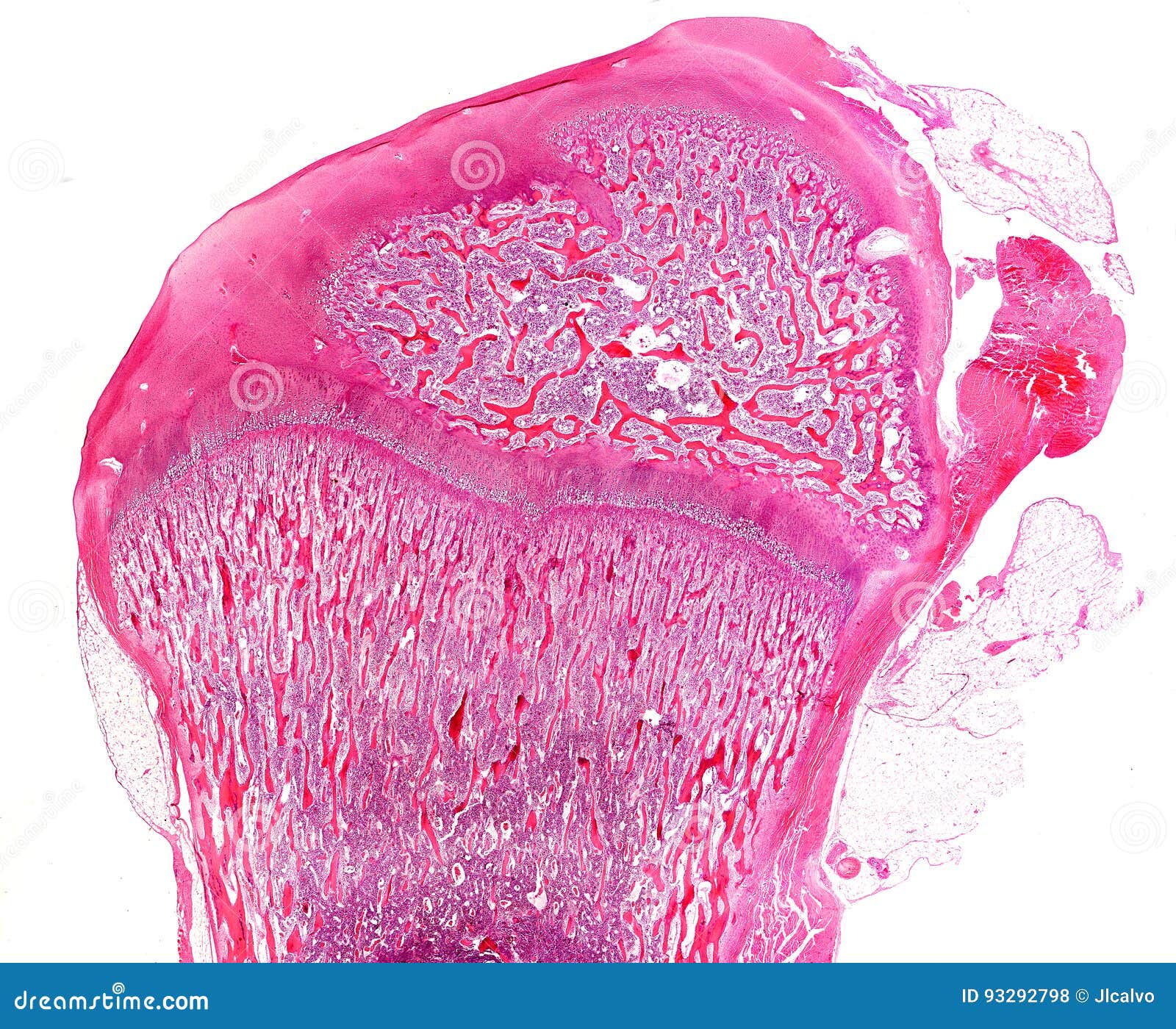 Developing Long Bone. Growth Plate Stock Photo - Image of diaphysis ...