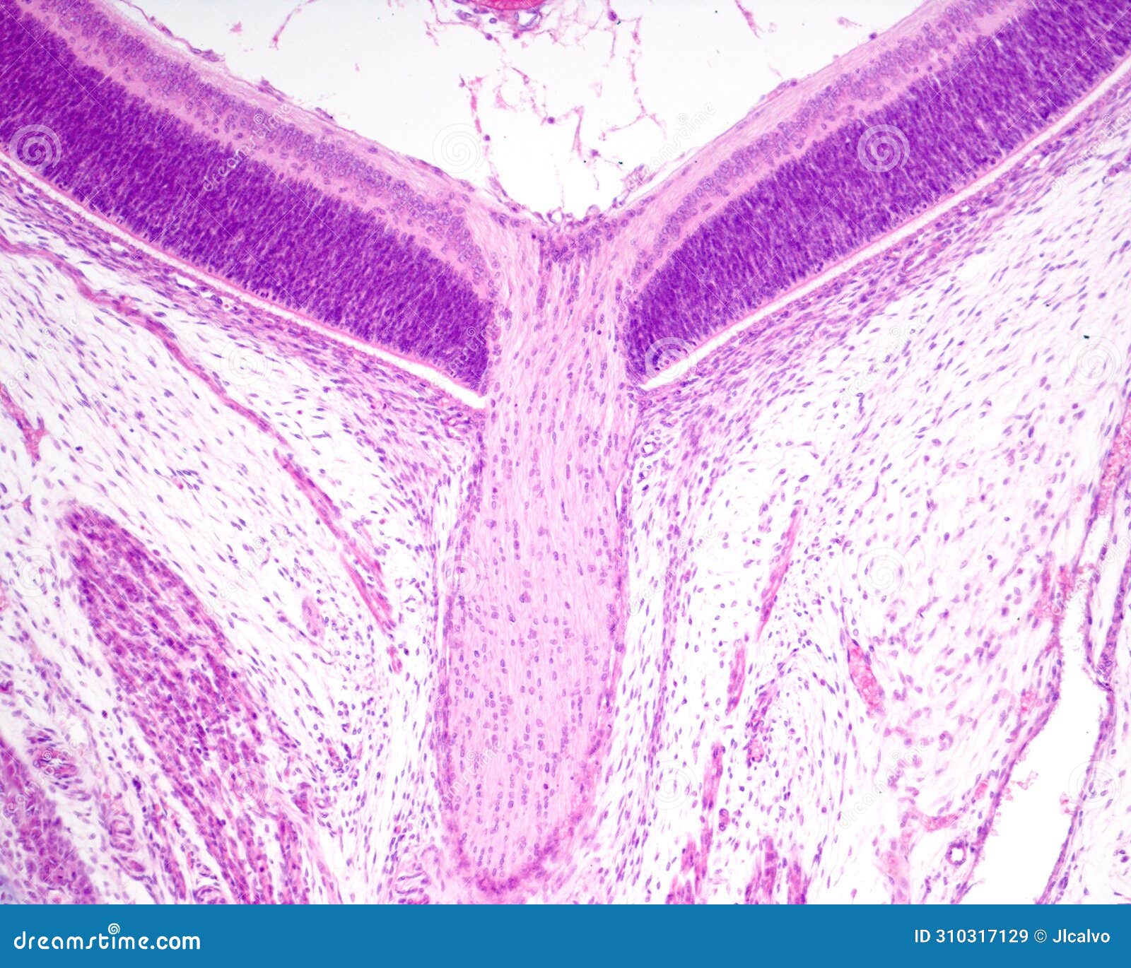 Developing Retina. Optic Nerve Stock Image - Image of optic, anatomy ...