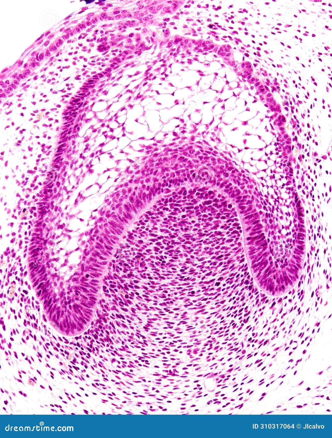Developing Tooth. Bell Stage Stock Photo - Image of histological, germs ...