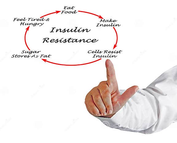 Development of Insulin Resistance Stock Photo - Image of lecturer ...