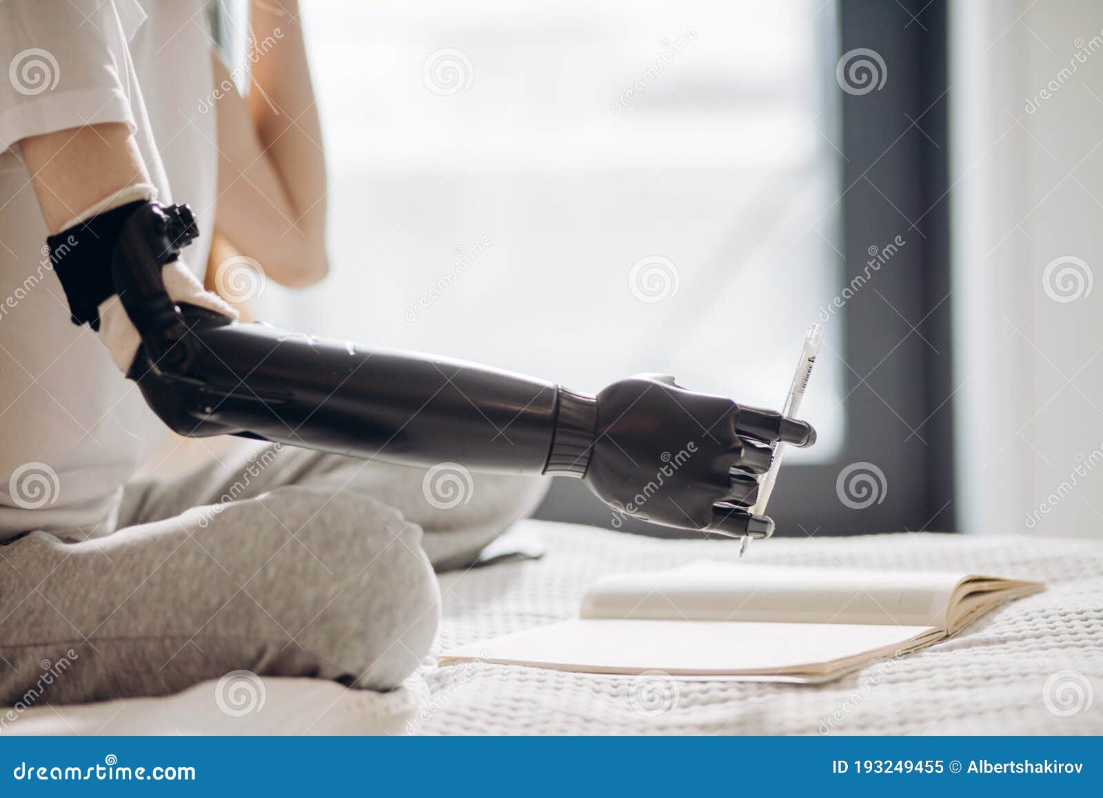 Development in Prosthetic Arm Systems Stock Image - Image of female ...
