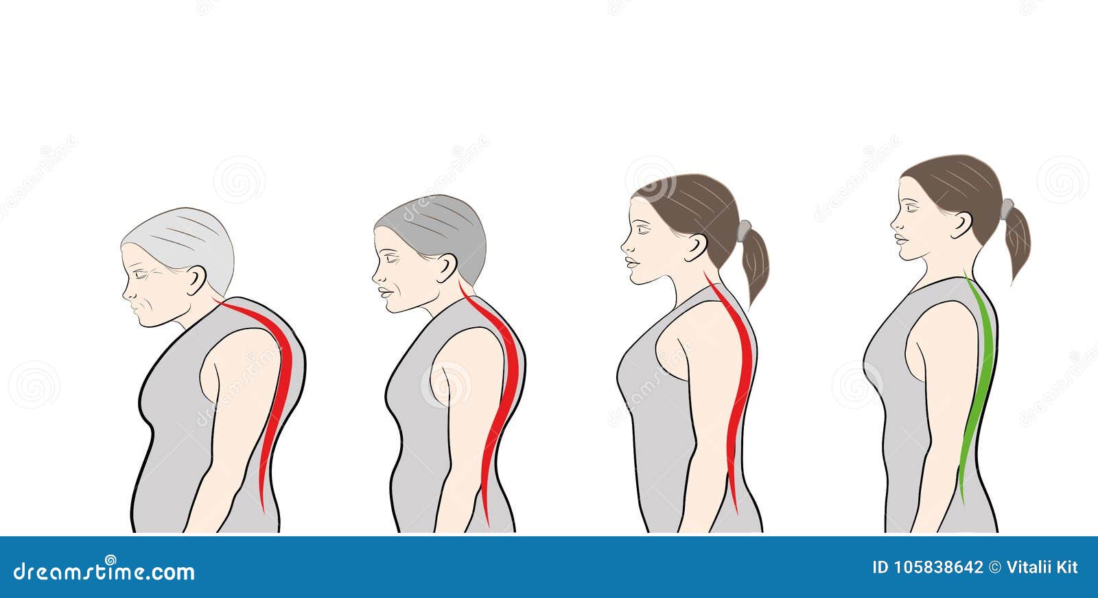 Development Of A Stooped Stance With Age, Showing Stock Vector ...