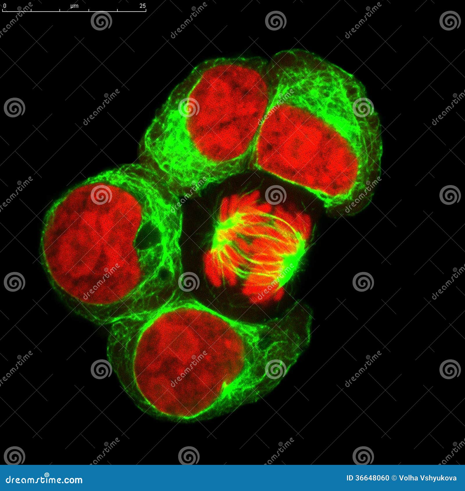 Mitosis Cell In The Root Tip Of Onion Under A Microscope. Stock Image ...