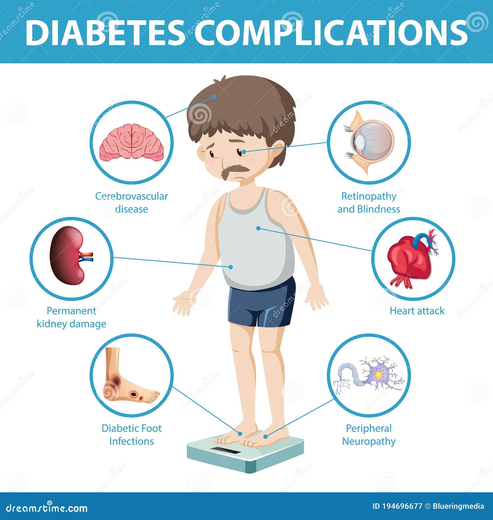 Diabetes Complications Information Infographic Stock Vector ...