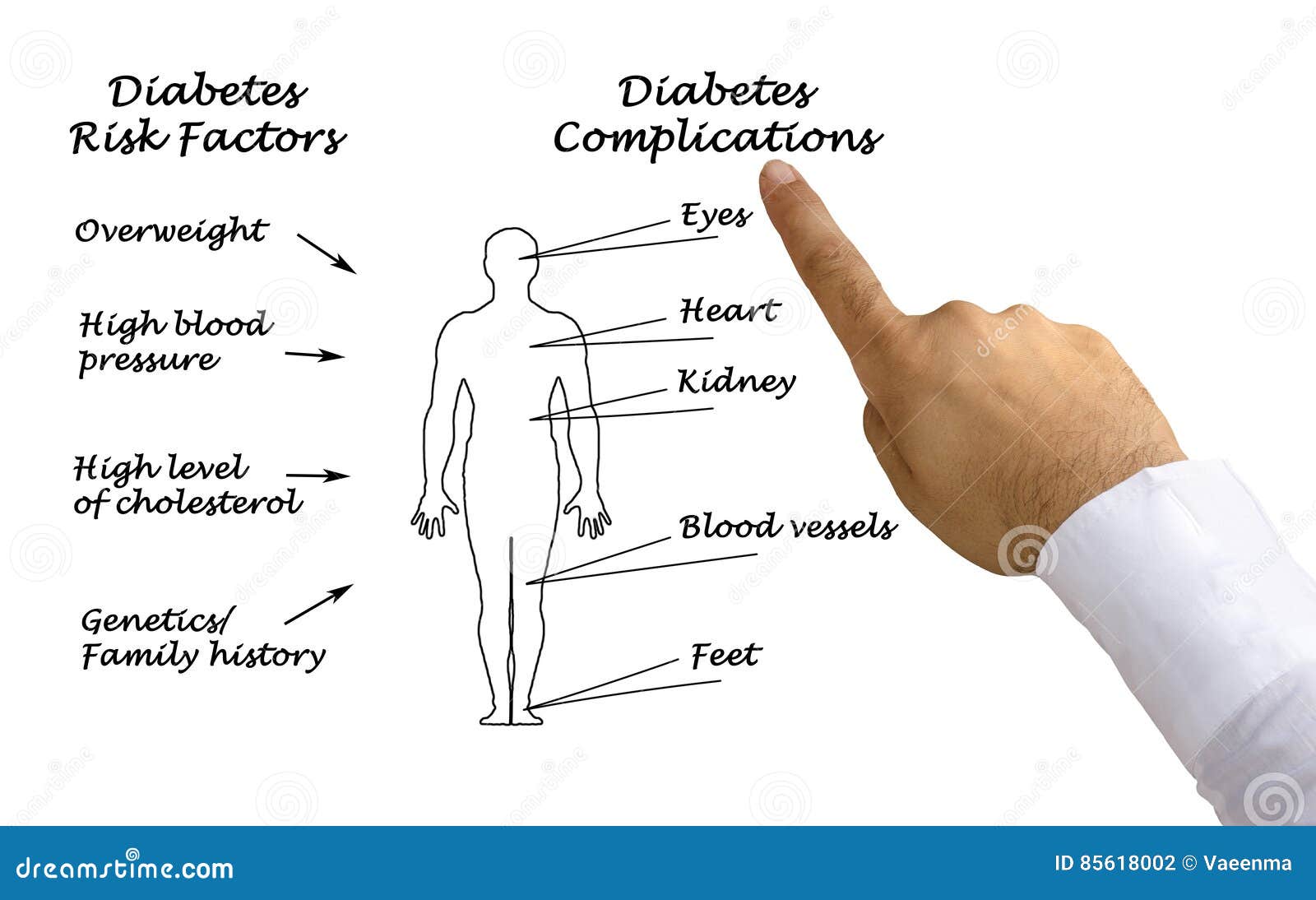 Diabetes Complications And Diseases Medical 3d Illustration On White ...