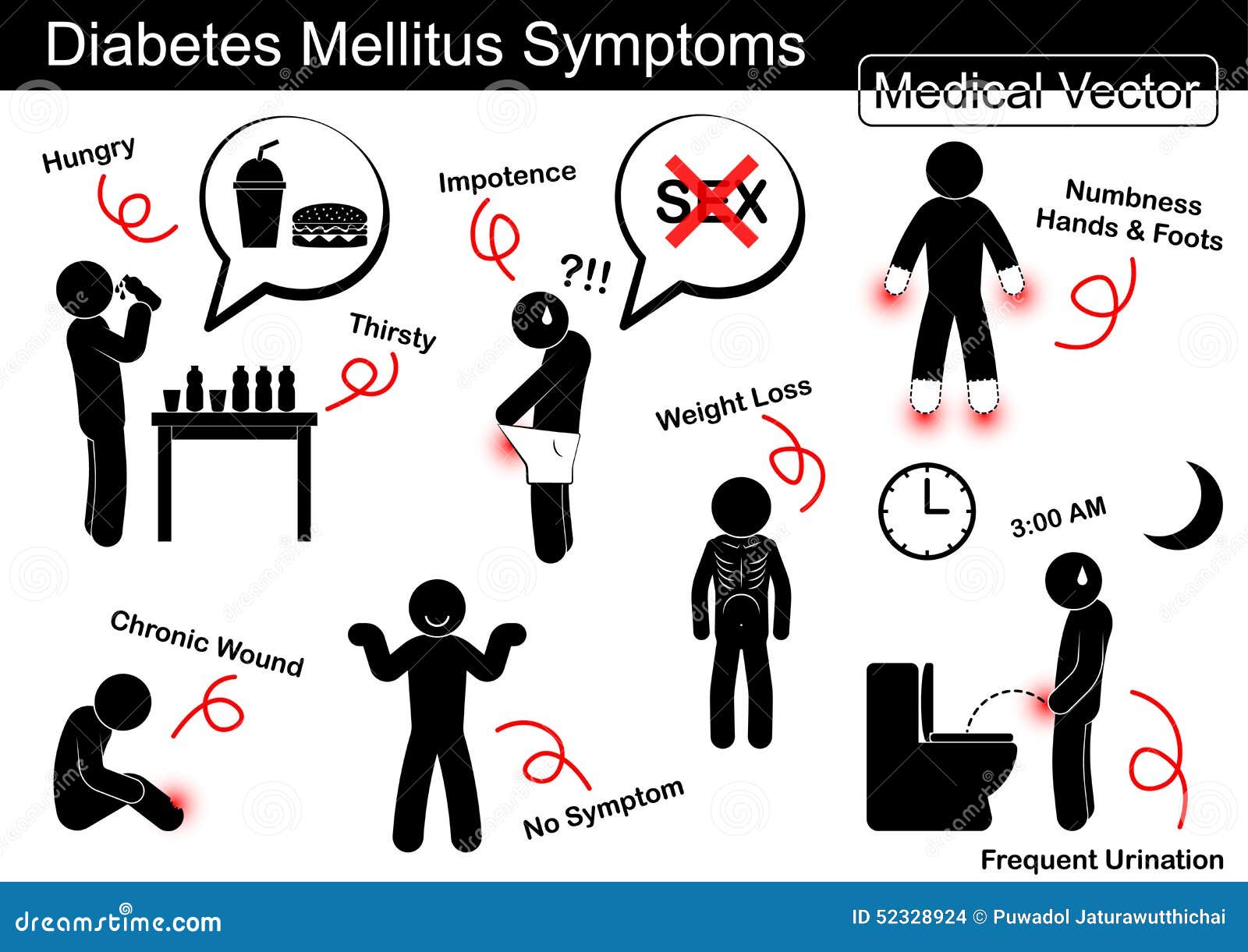 Diabetes Mellitus (DM) Symptomen (hongerig En De Dorstige Verhoging, De ... Diabetes Mellitus (DM) Symptomen (hongerig En De Dorstige Verhoging, De ...