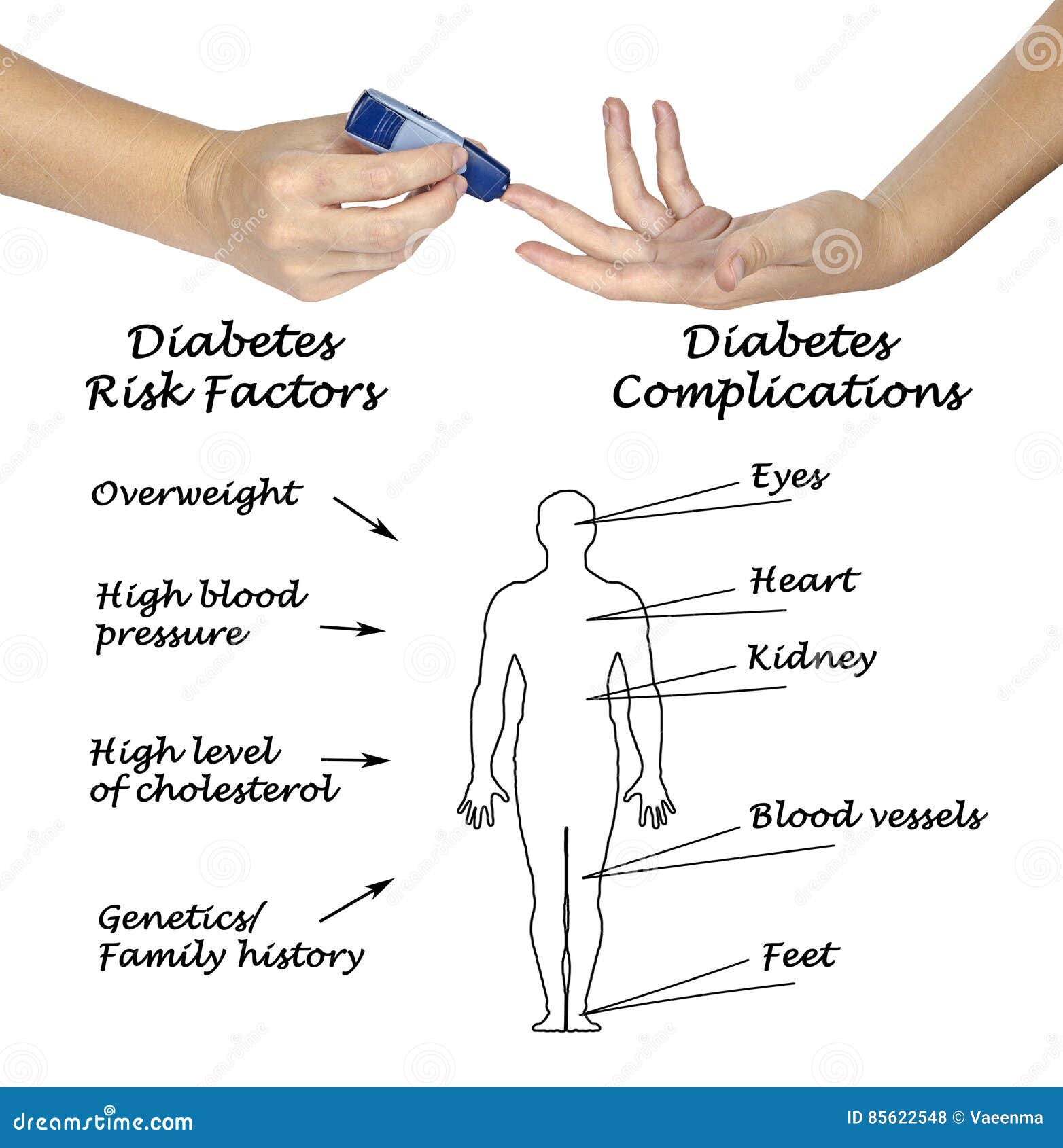 Complications Of Diabetes