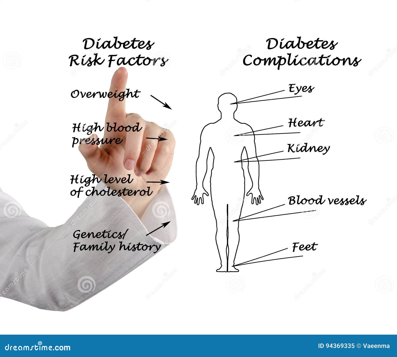 Diabetes Risk Factors and Complications Stock Image - Image of failure ...