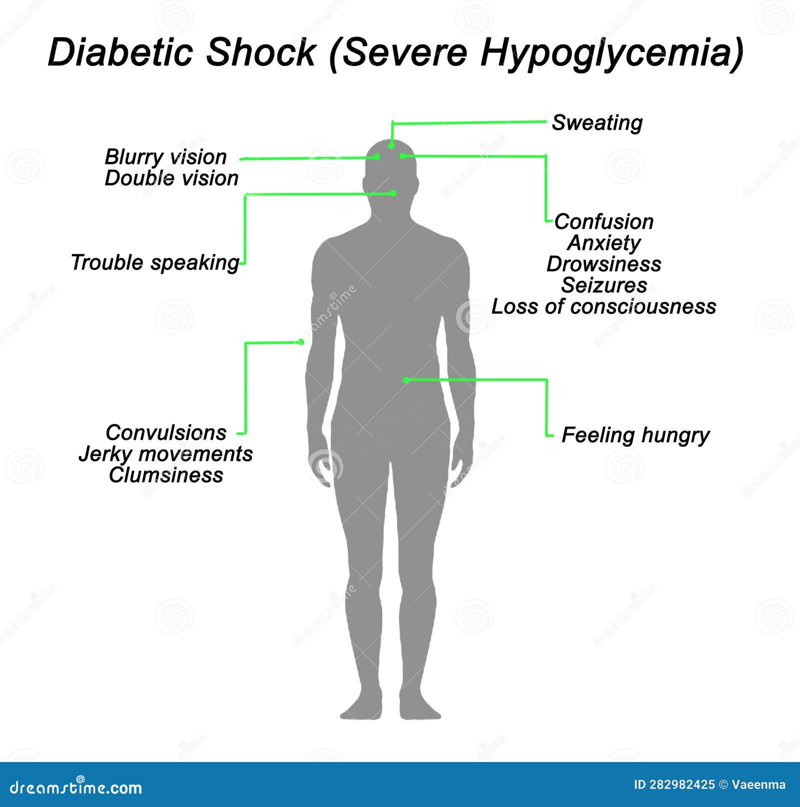 Diabetic Shock (Severe Hypoglycemia Stock Image - Image of 3625 ...